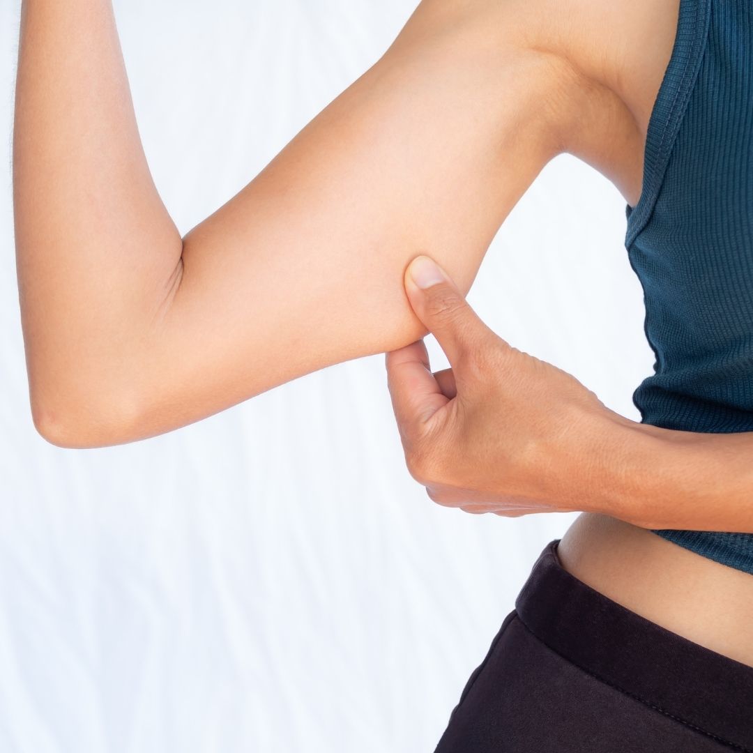 Weight Loss & Saggy Skin – Skinny Up!